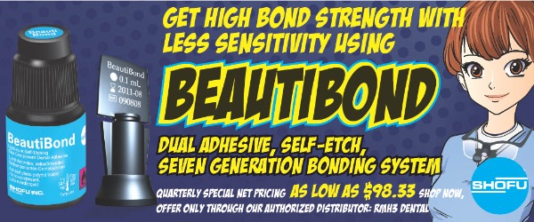 What Generation is Optibond Solo Plus: Ultimate Guide Revealed - BackupWatt